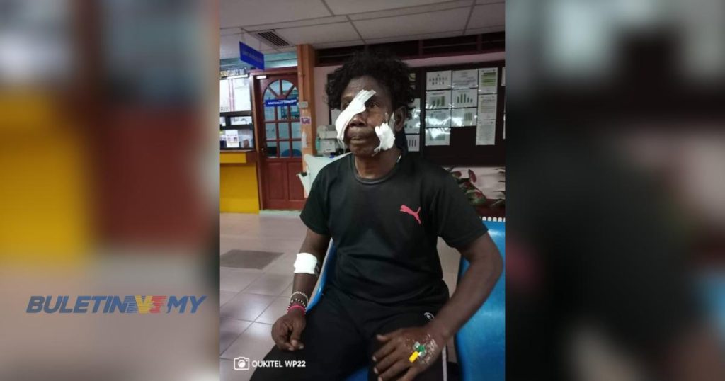 Orang Asli cedera diserang harimau ketika menyumpit | BULETIN TV3 Malaysia